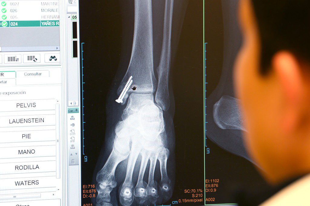 RAYOS X | Scantibodies Imagenología y Terapia